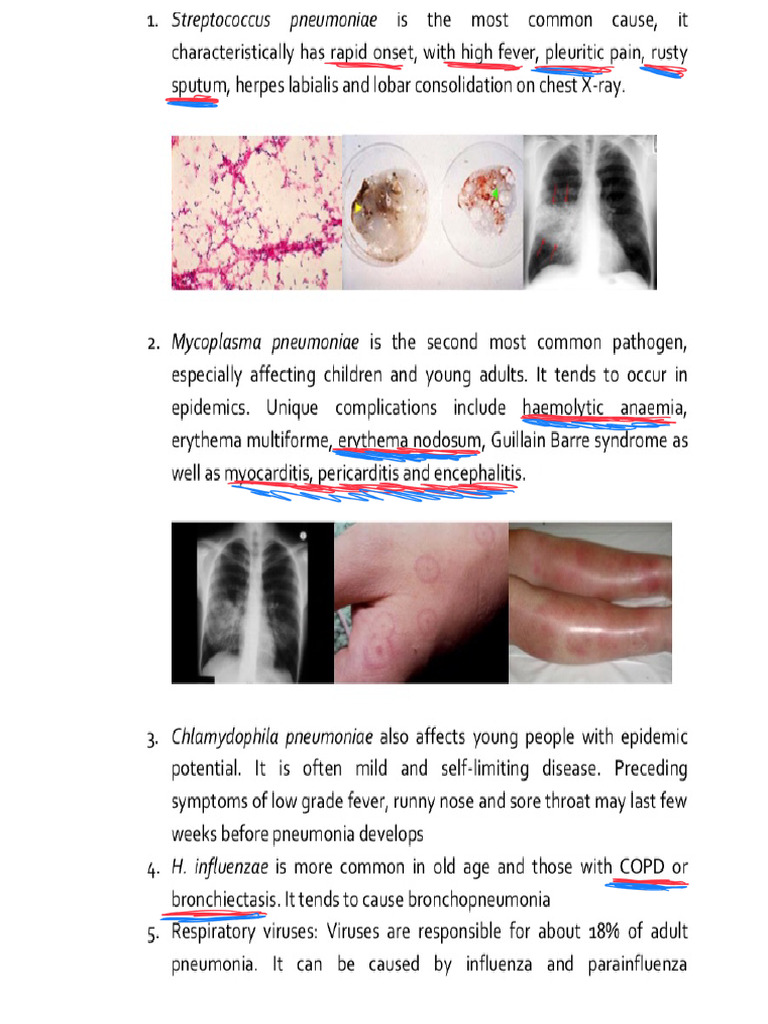 Community-Acquired Pneumonia | PDF | Pneumonia | Causes Of Death