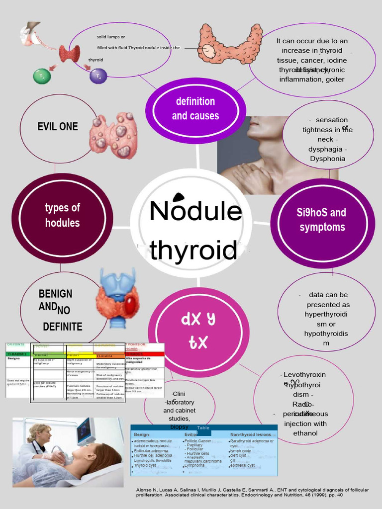 Thyroid Nodule Mind Map | PDF | Thyroid | Glands