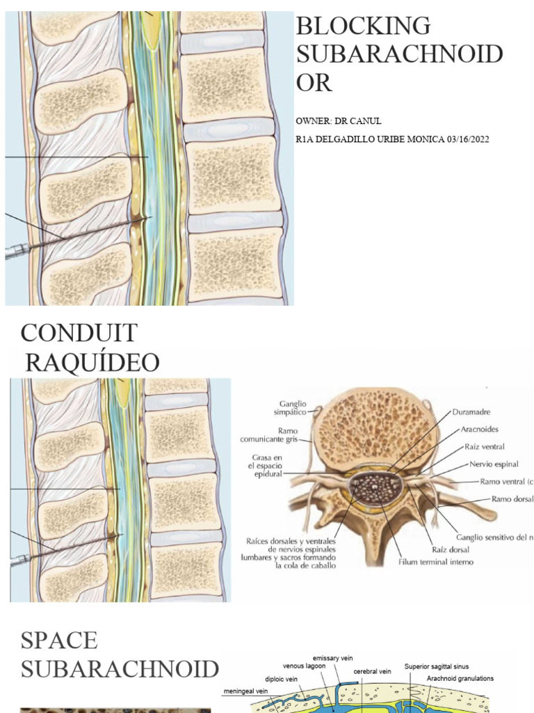 Subarachnoid Block | PDF | Anesthesia | Cerebrospinal Fluid