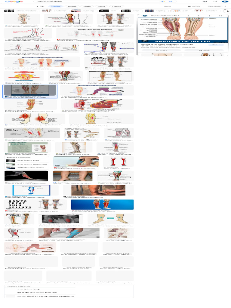 Medial Shin Splints - Google Search | PDF | Physical Therapy | Musculoskeletal System