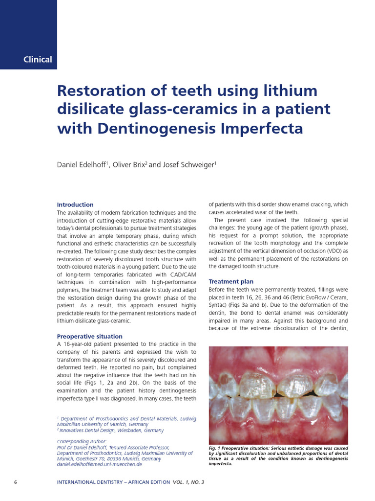 DENTINOGENESIS IMPERFECTA Edelhoff - Brix - Schweiger Dentinogenesis ...