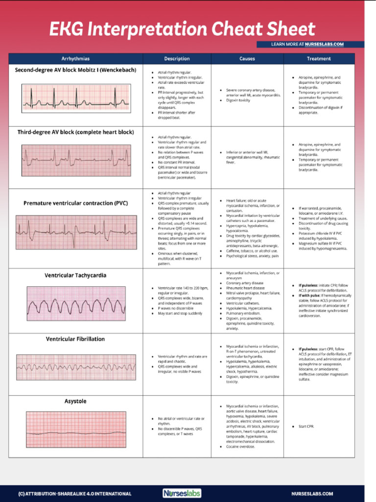EKG Cheat Sheet | PDF