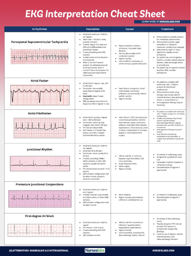 EKG Cheat Sheet Part 2 | PDF