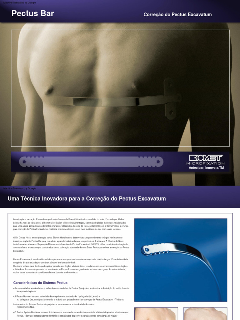 Pectus Bar Overview Technique (1) | Download grátis PDF | Medicina ...