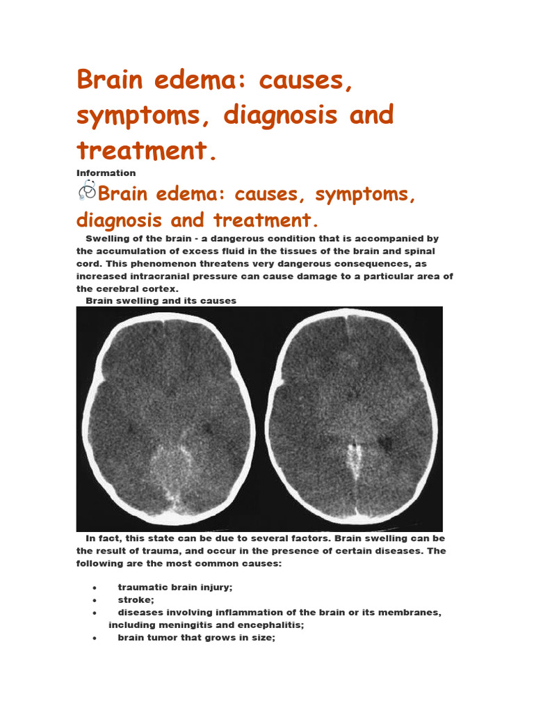 Cerebral Edema | PDF | Edema | Stroke