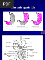 Understanding Gastritis: Causes & Treatment | PDF | Gastroenterology ...