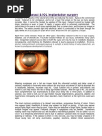 CT LUCIA 602 IOL Specifications and Safety | PDF | Optics | Vision