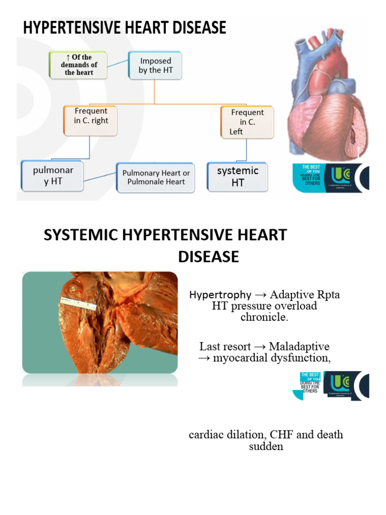 Hypertensive Heart Disease | Download Free PDF | Heart Valve | Heart