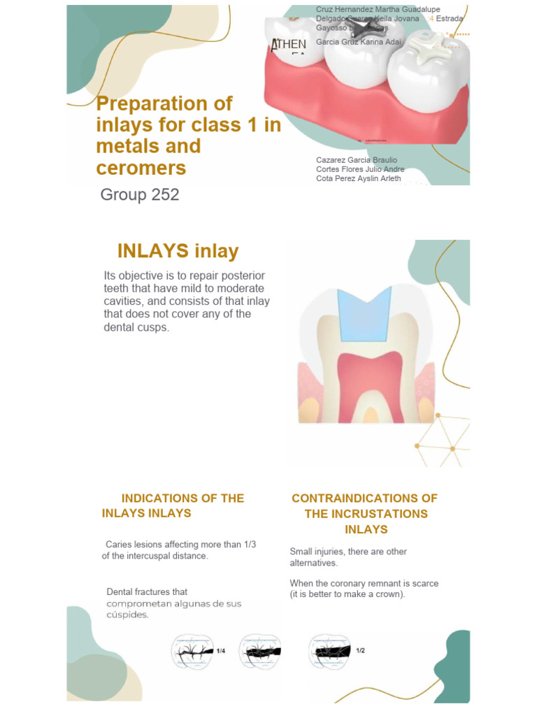 Inlay Inlays | PDF | Dental Anatomy | Mouth