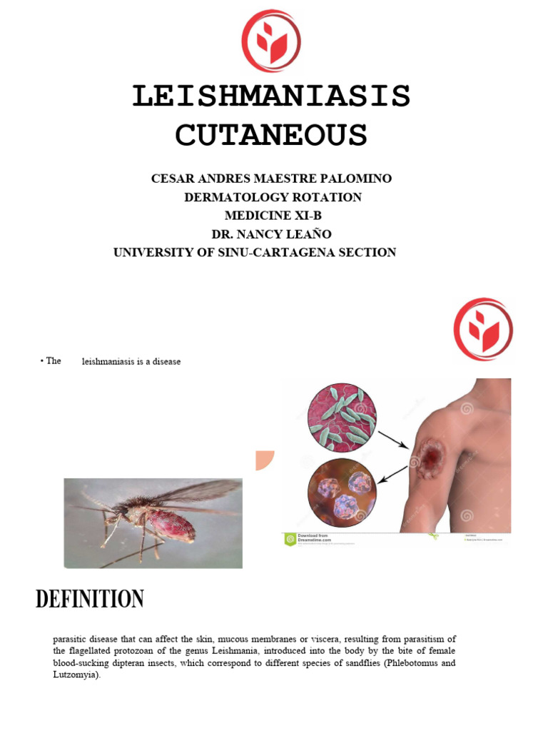 Cutaneous Leishmaniasis | PDF | Medicine | Diseases And Disorders