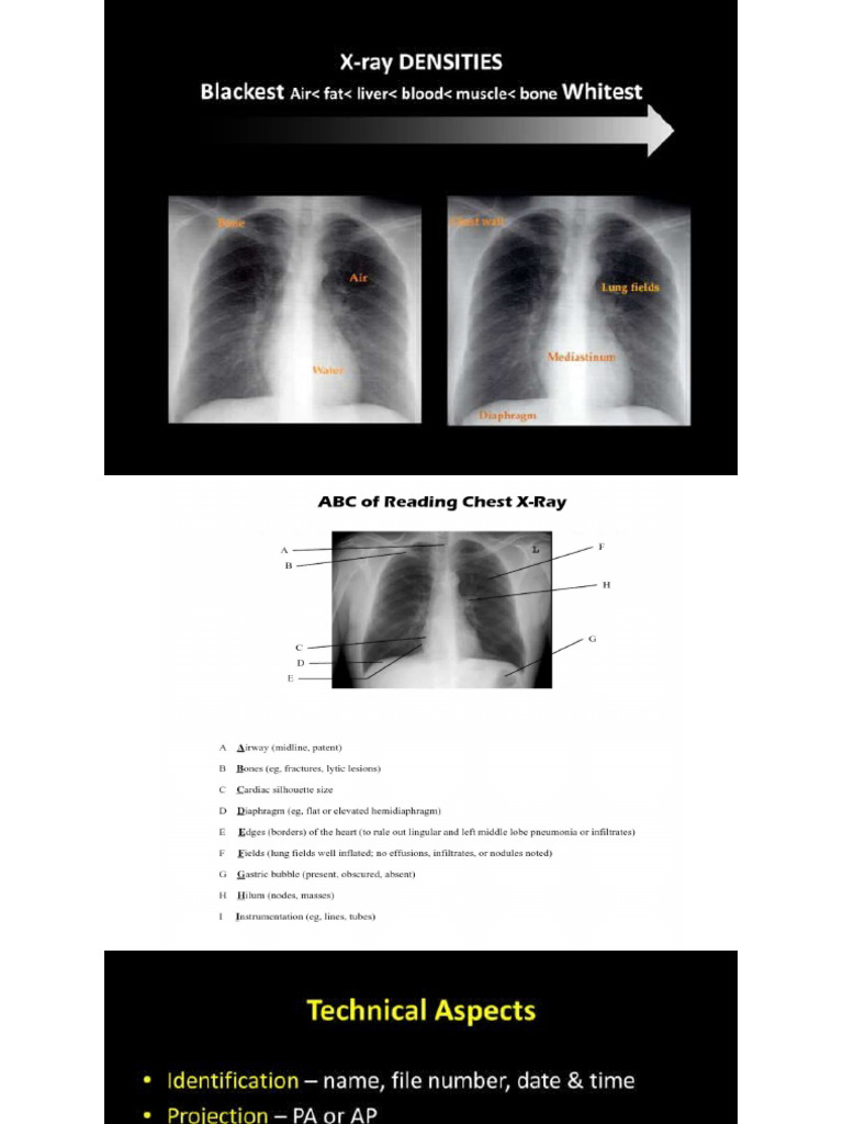 Xray Class | PDF