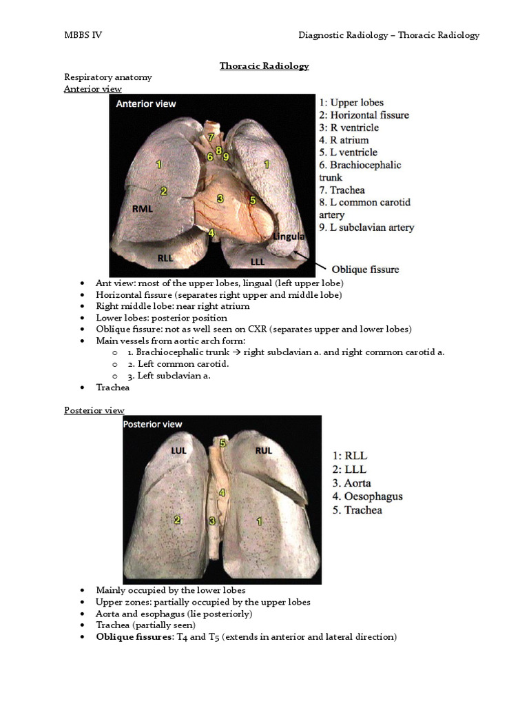 Diagnostic Radiology - Thoracic Radiology | PDF | Lung | Aorta