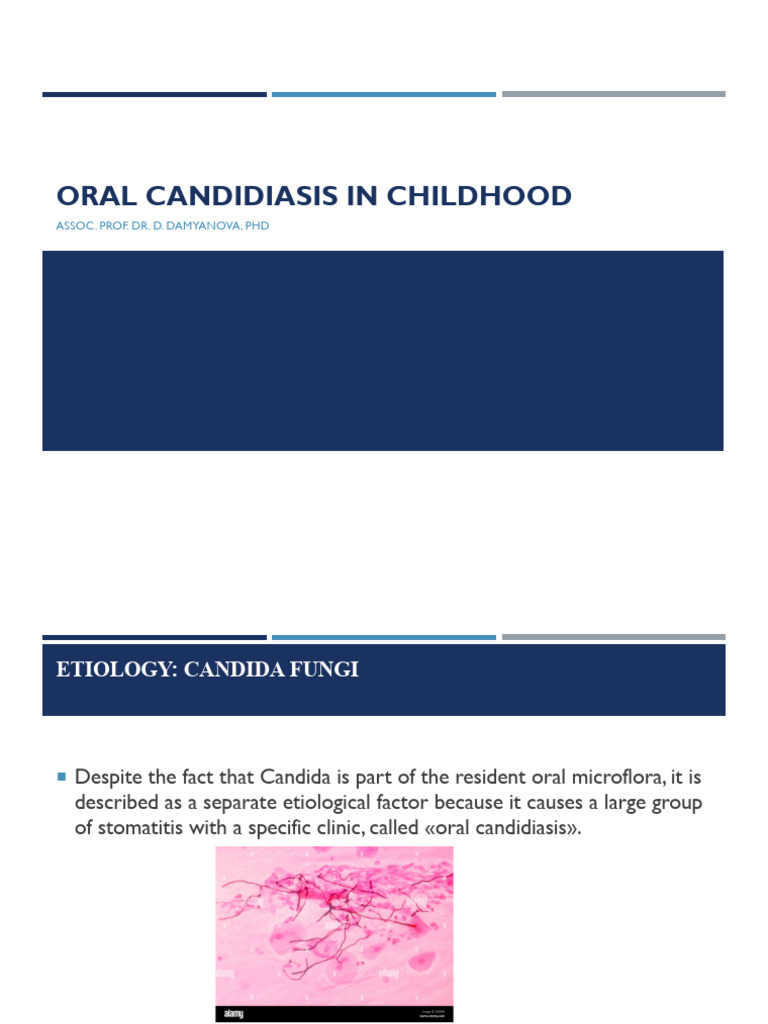 Candidosis 1 | PDF | Candida (Fungus) | Candidiasis