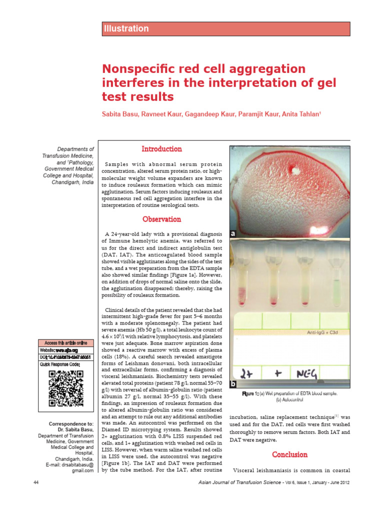 Nonspecific Red Cell Aggregation | PDF | Blood Plasma | Serology