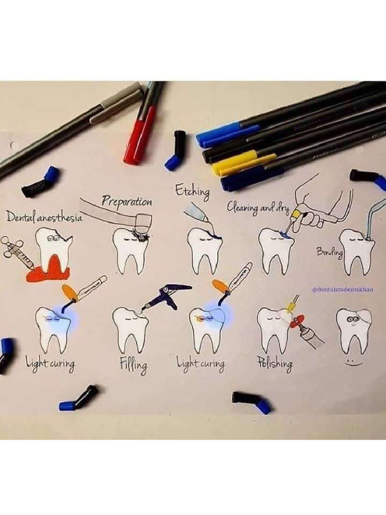 Dental Composite Restoration Animation | PDF