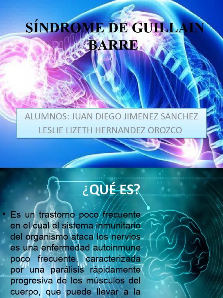 Síndrome de Guillain-Barré: Causas y Tratamiento | PDF | Medicina ...