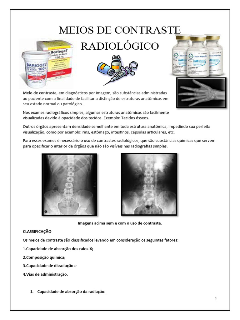 Aula Meios de Contraste Radiologia | PDF | Sal (Química) | Radiografia