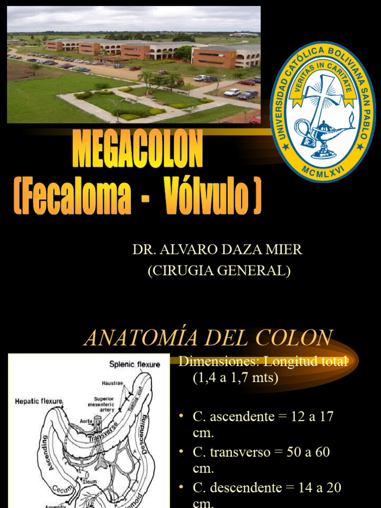 Mega Colon | PDF | Intestino grueso | Gastroenterología