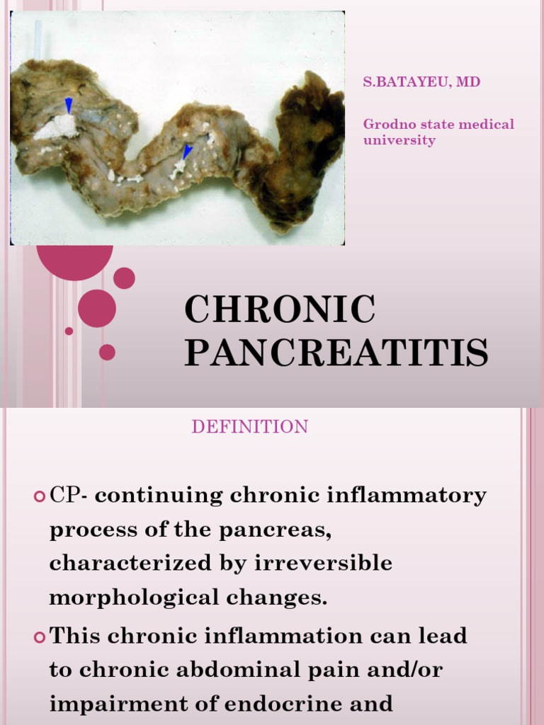 Chronic Pancreatitis | PDF | Pancreas | Diabetes