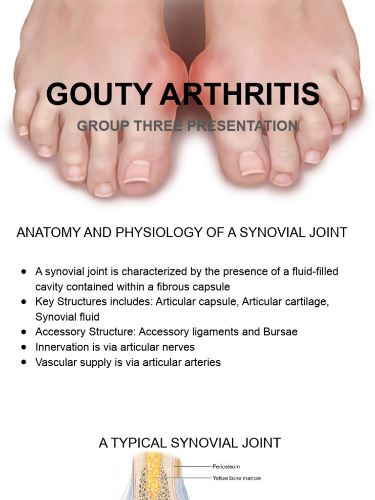 Gouty Arthritis Group 3 | PDF | Gout | Arthritis