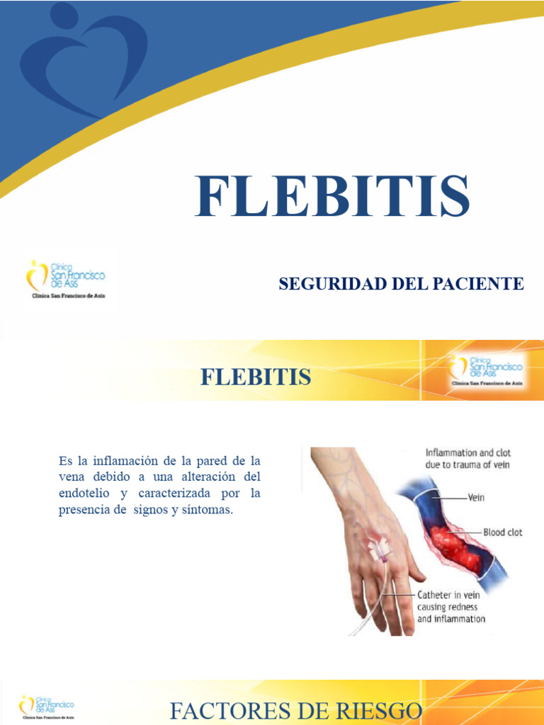Presentación Flebitis | PDF | Terapia intravenosa | Enfermedades y ...