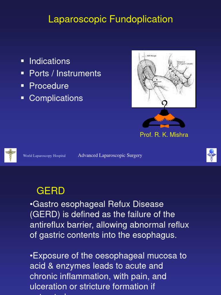 Laparoscopic Fundoplication | PDF | Gastroesophageal Reflux Disease ...