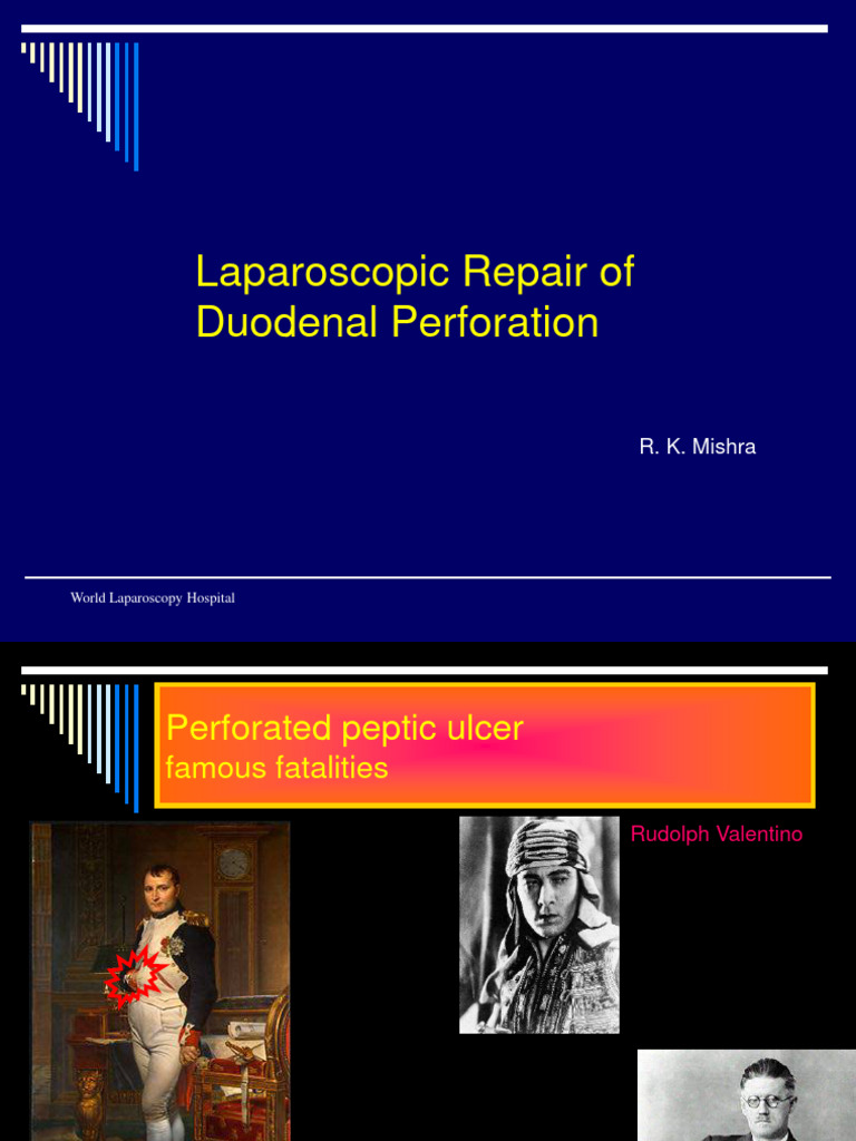 Laparoscopic Management of Duodenal Perforation | PDF | Diseases And ...