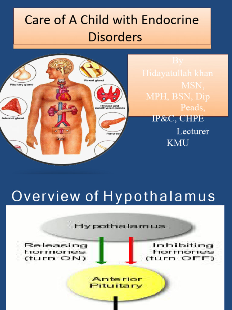 Endocrine Disorders in Children | PDF | Diabetes | Hyperglycemia