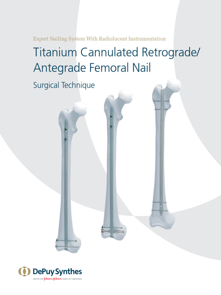 Retrograde Antegrade Femoral Nail Surgical Technique Guide | PDF | Screw | Knee