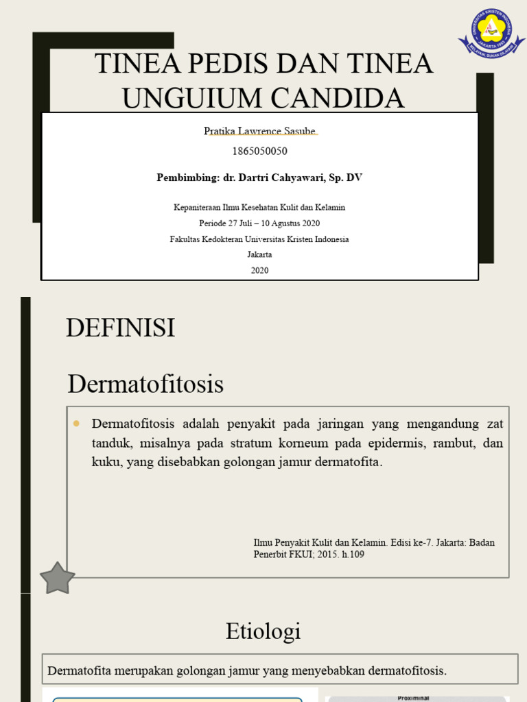 BST Tinea Pedis Unguium | PDF