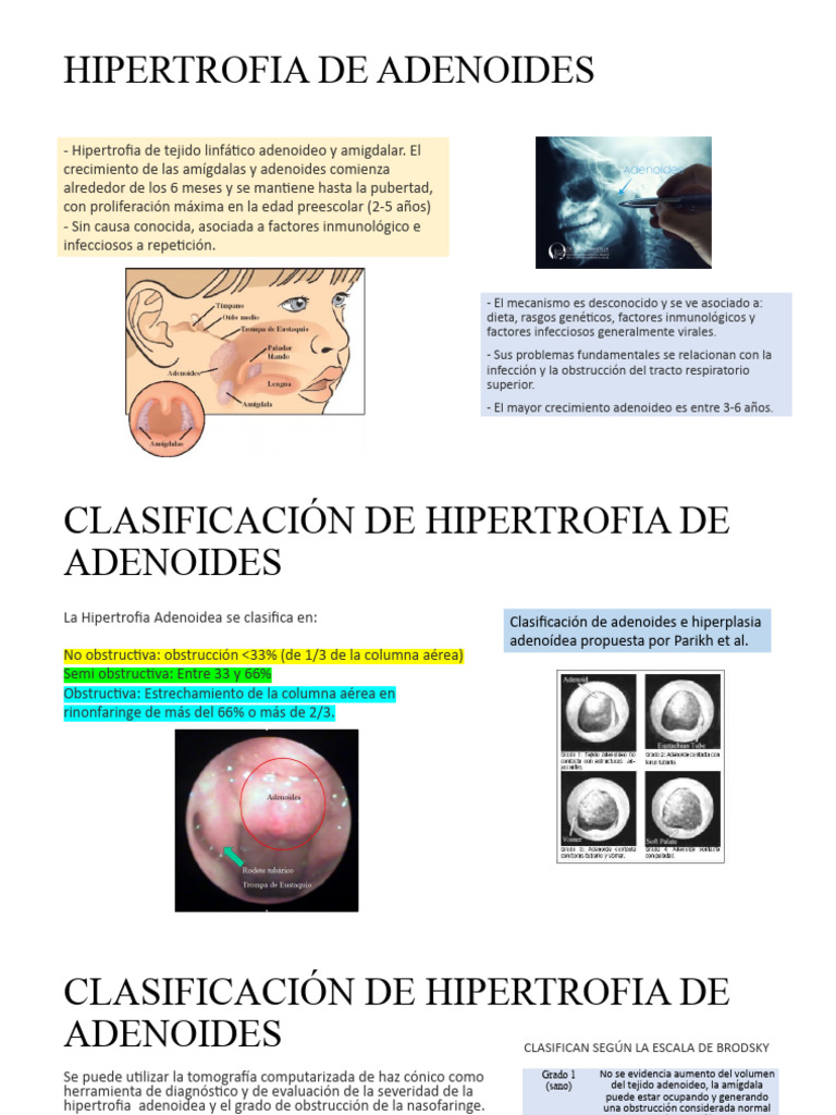 Hipertrofia de Adenoides | PDF | Inmunología | Enfermedades y trastornos