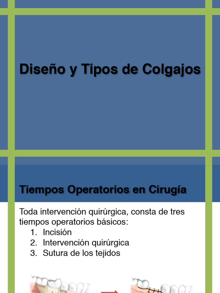 Diseño y Tipos de Colgajos Quirúrgicos | PDF | Cirugía | Medicina CLINICA