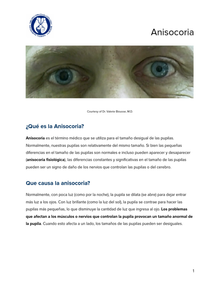 Anisocoria Espanol | PDF | Nervio | Ojo