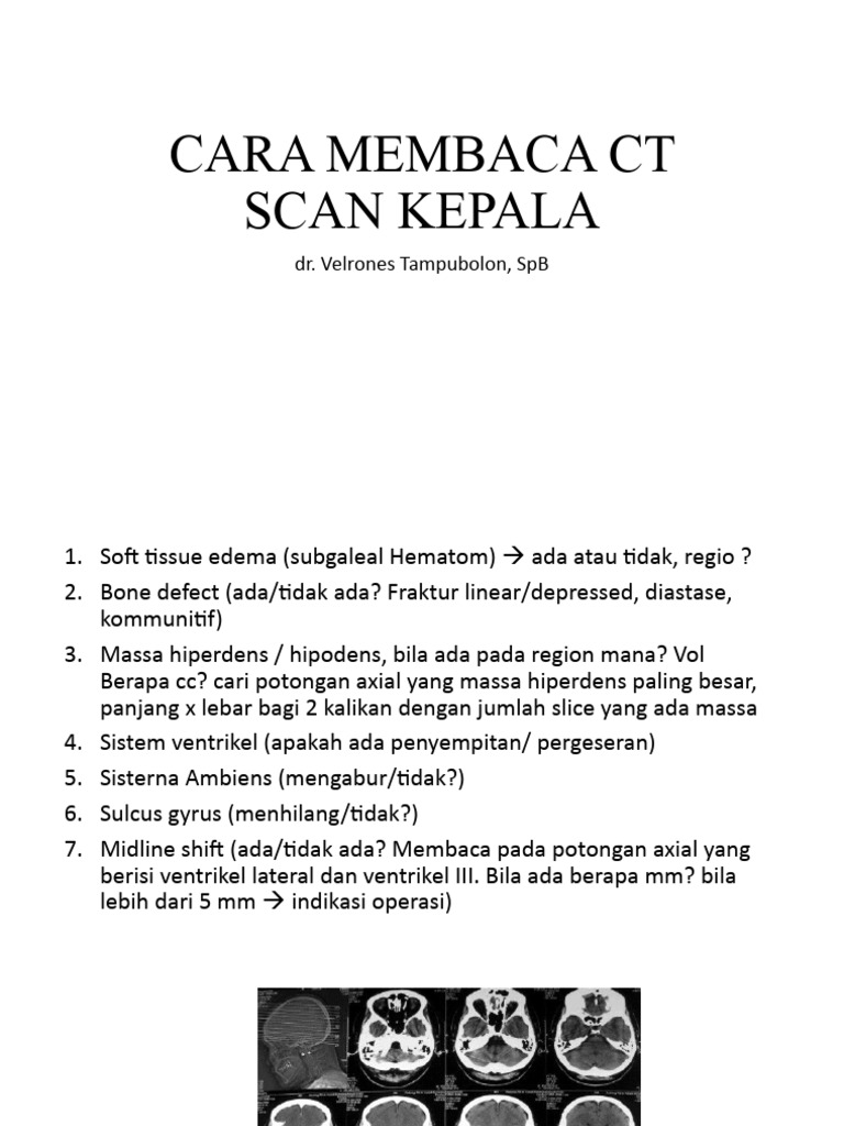 CARA MEMBACA CT SCAN KEPALA | PDF