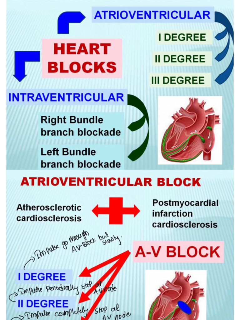 Heart Blocks ECG by POLSKAYA | PDF