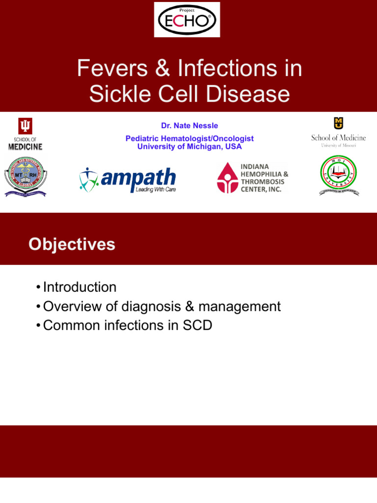Fever and Infection in Sickle Cell Disease | PDF | Sepsis | Meningitis