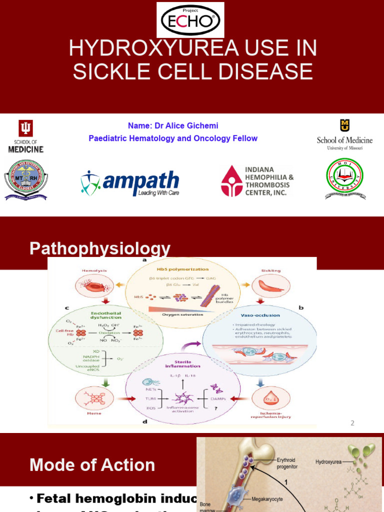 Hydroxyurea Use in Sickle Cell Disease | PDF | Anemia | Drugs