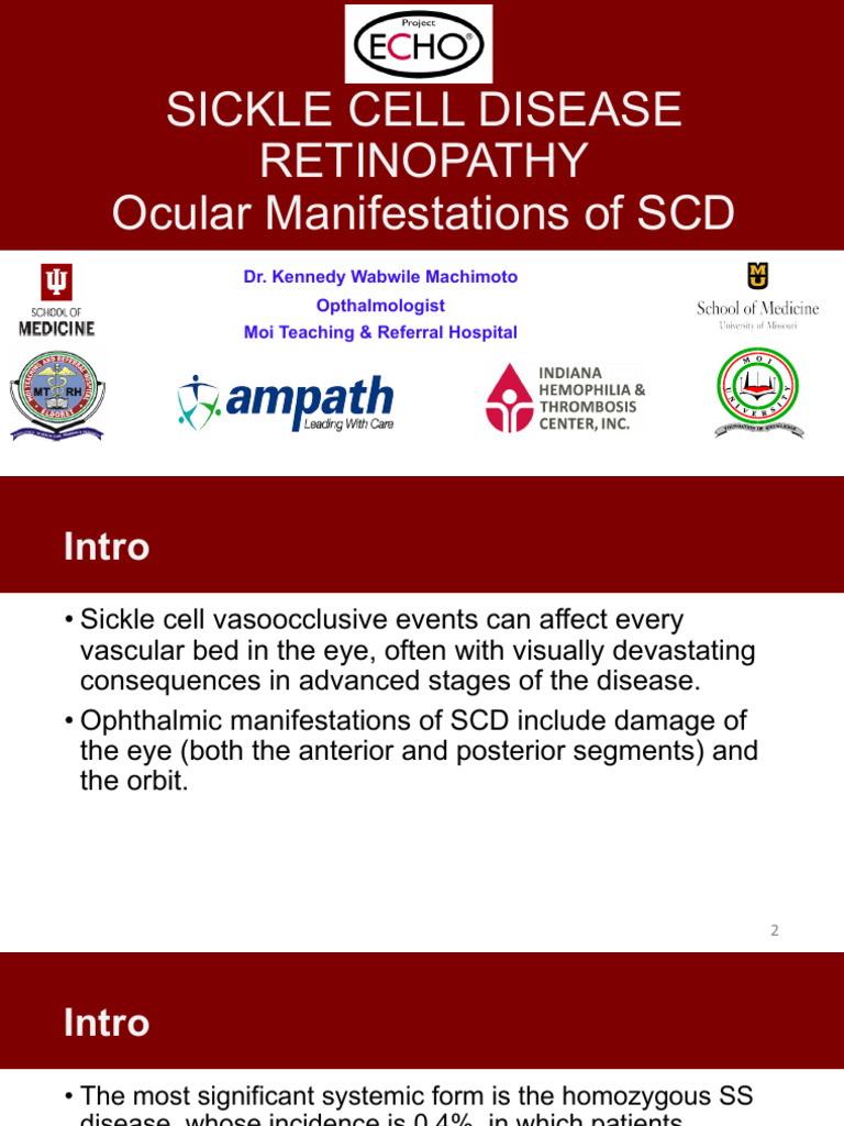 Sickle Cell Disease Retinopathy | PDF | Human Eye | Clinical Medicine