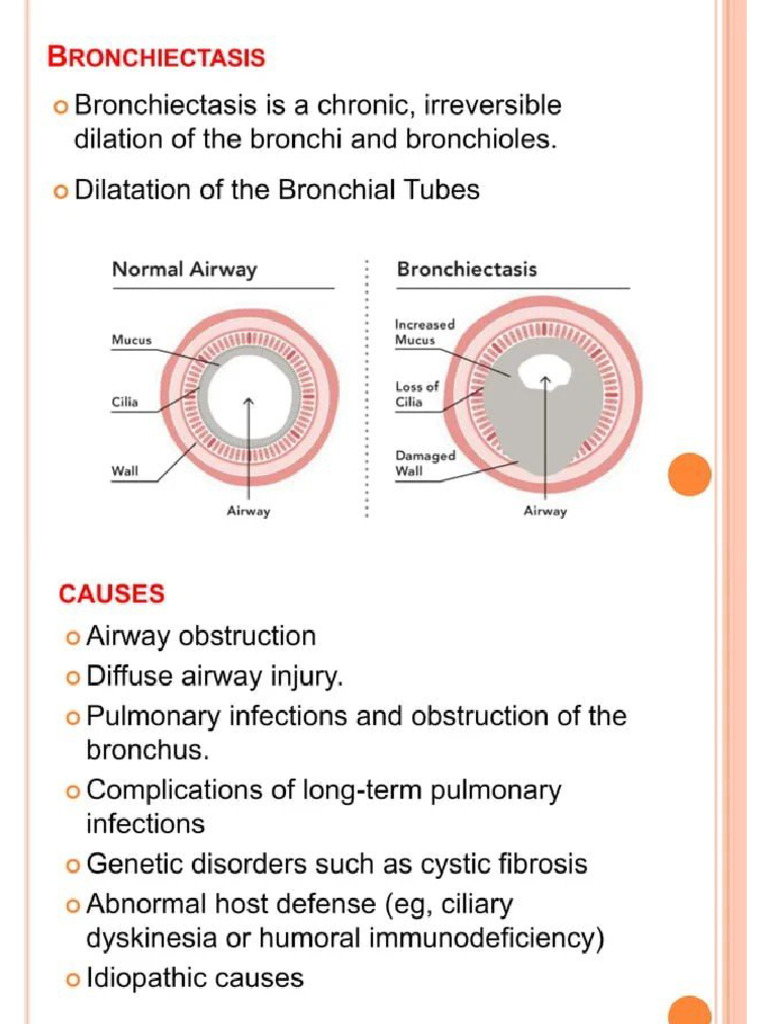 Bronchiectasis | PDF