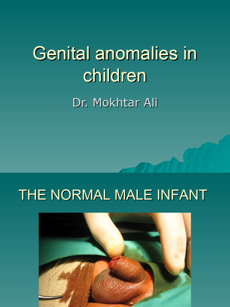 Genital Anomalies in Children - A Foto-diagnosis | PDF | Urology | Sexual Anatomy