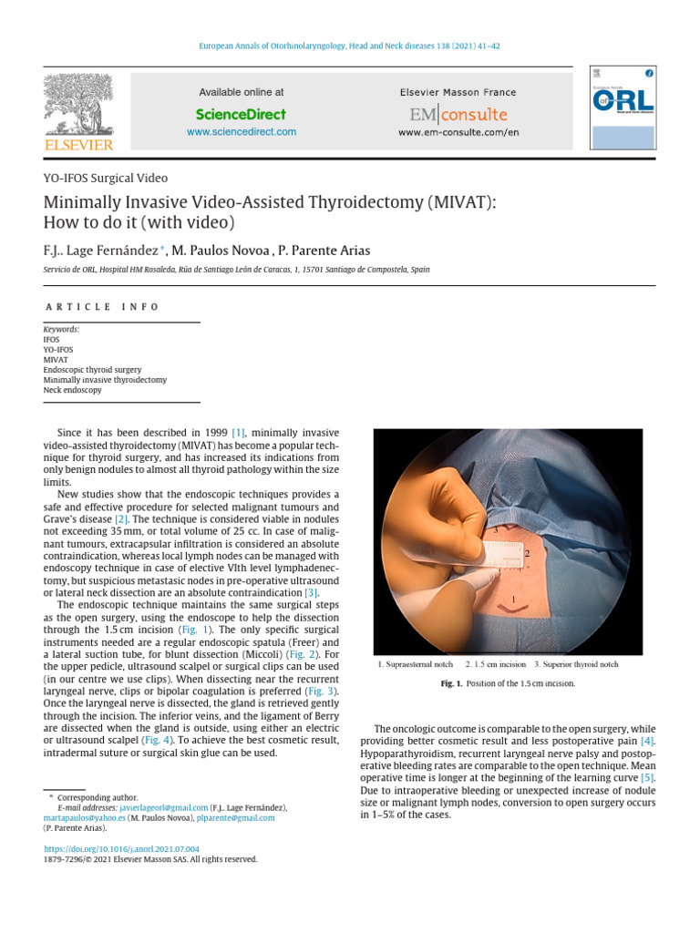 2021 Minimally Invasive Video-Assisted Thyroidectomy (MIVAT) | PDF | Surgery | Thyroid