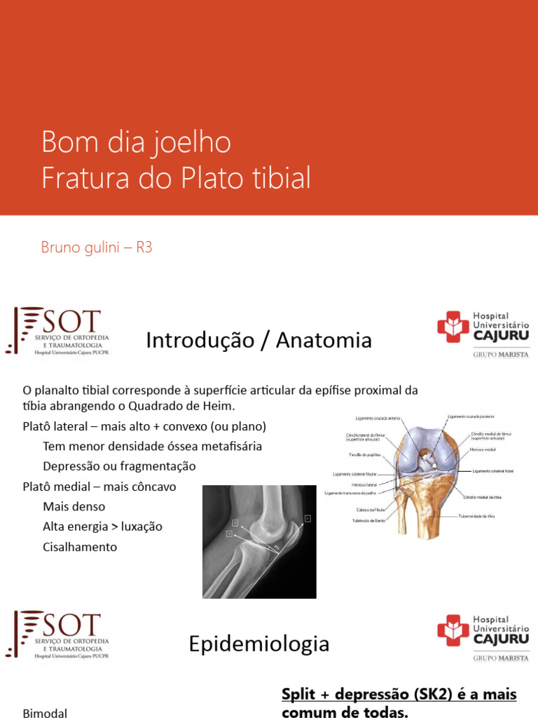 Fratura do Platô Tibial: Anatomia e Tratamento | PDF | Joelho | Sistema ...