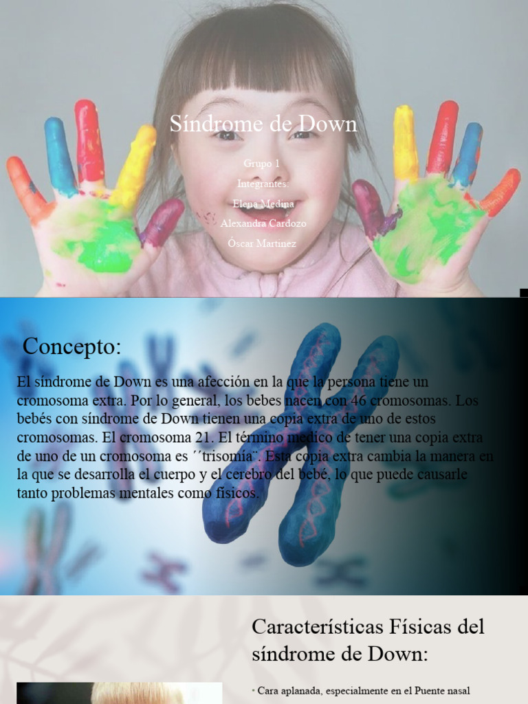 Síndrome de Down | PDF | Síndrome de Down | Medicina CLINICA