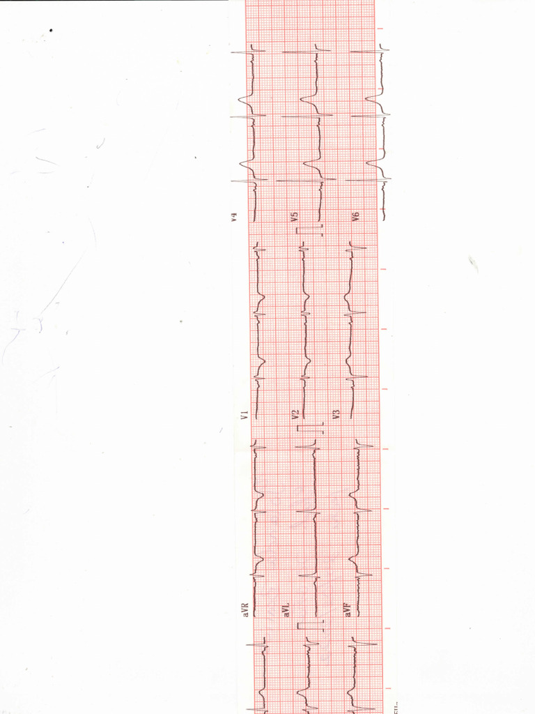 Electrocardiogram A | PDF