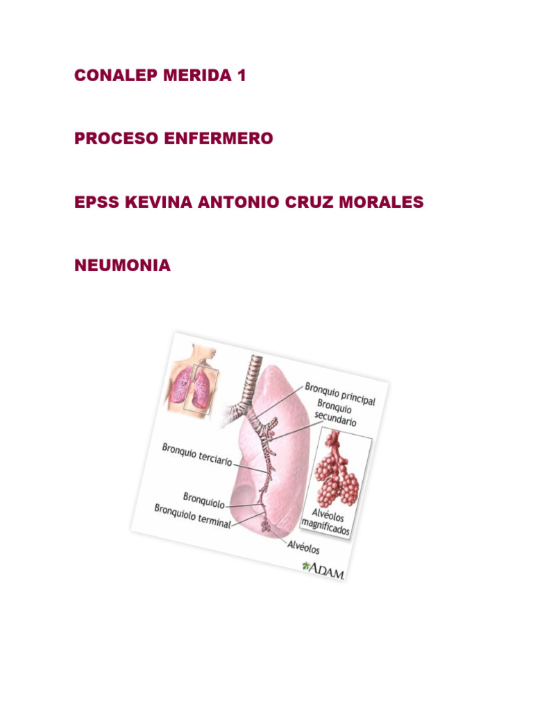 Neumonía: Anatomía y Fases Evolutivas | PDF | Neumonía | Vacuna contra ...