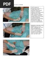 Colocacion y Retiro de Sonda Foley 2021 | PDF | Sistema urinario | Medicina