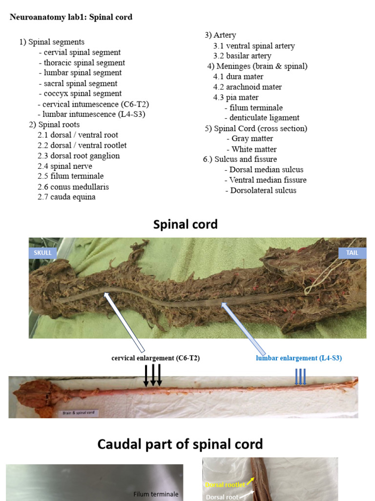 Neuro Lab (Spinal Cord+Telencephalon)2024 | PDF | Cerebrum | Spinal Cord