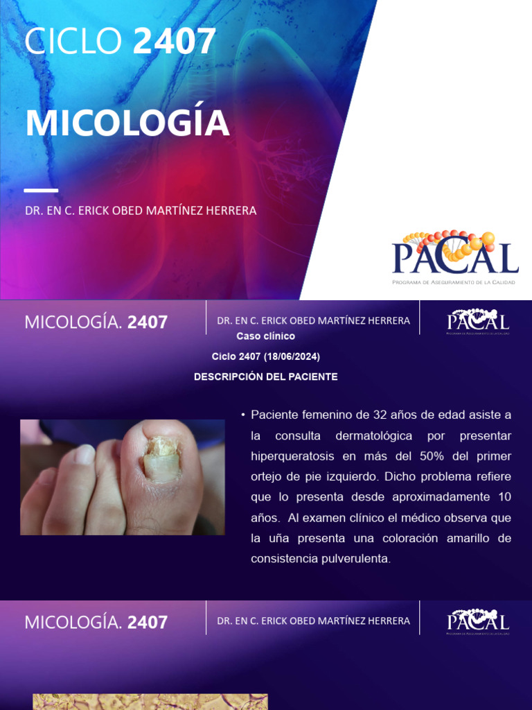 Caso Mico 2407 | PDF | Dermatología | Especialidades Medicas