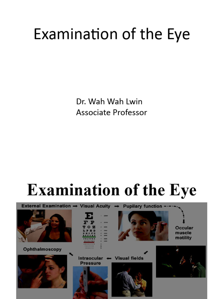 Examination of The Eye | PDF | Glaucoma | Human Eye