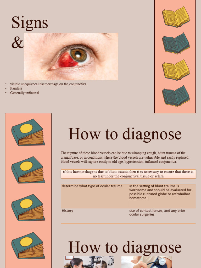 CMD Subkonjungtiva Bleeding | PDF | Bleeding | Human Eye